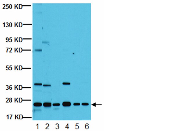 Anti-ARF1 Antibody, clone 3F1 | 05-1427